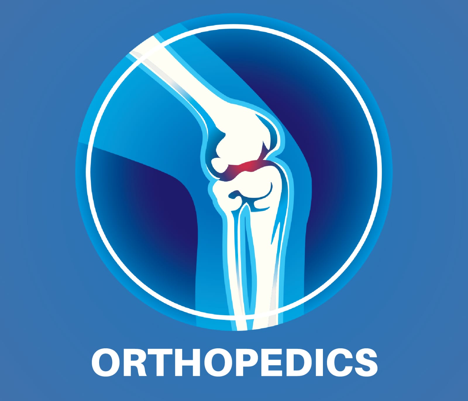 Bone treatment Hospital in Chennai - Peacock Hospital