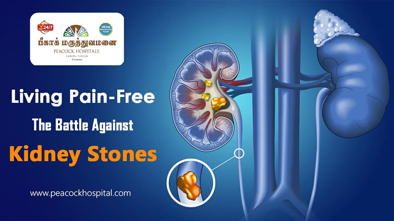kidney Stones Treatment | Thiruttani | Peacock hospitals